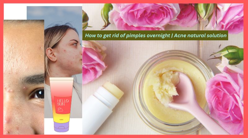 How to get rid of pimples overnight | Acne natural solution