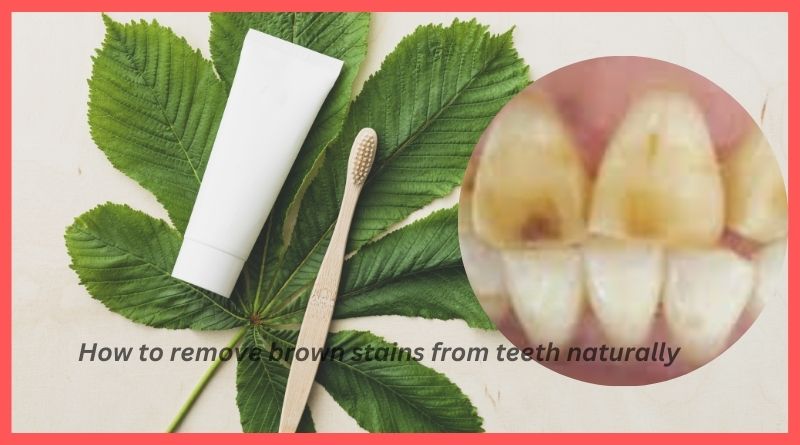How to remove brown stains from teeth naturally and more